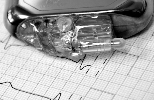 SSCPs: Next Steps for MDR Compliance